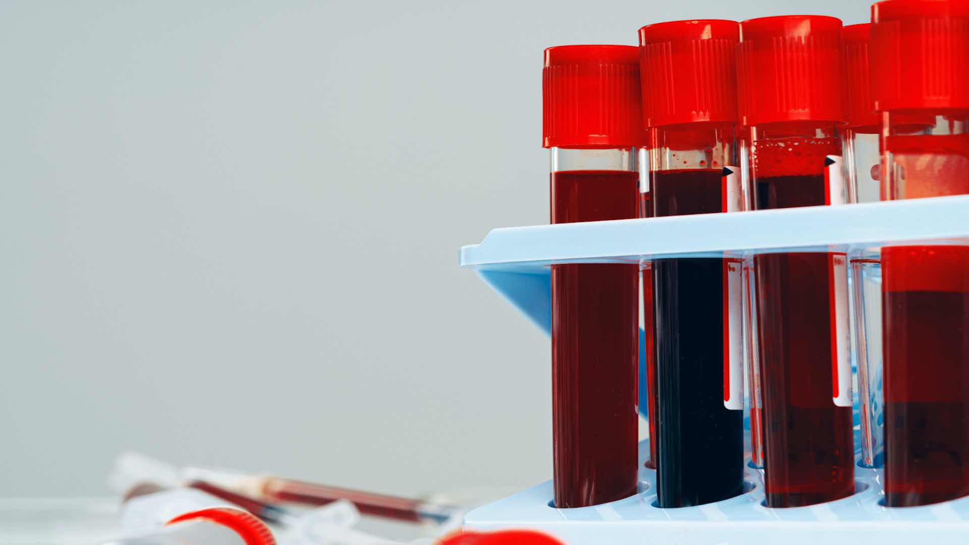 Innovative blood test introduced for cancer care in Abu Dhabi - Riyadh ...